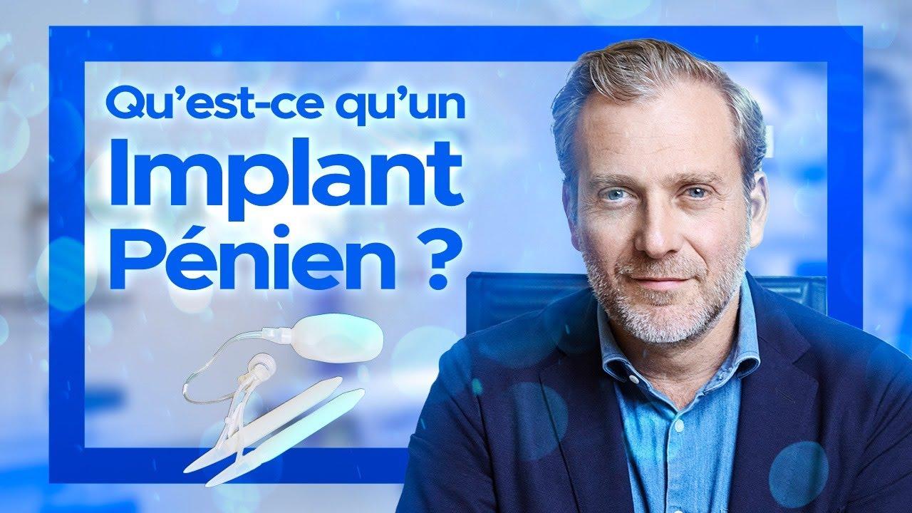 Qu’est-ce qu’un implant pénien ? Dr Beley (2025)
